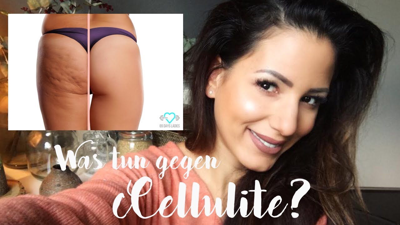 CELLULITE erfolgreich BEKÄMPFEN was tun GEGEN ORANGENHAUT - Behandlung/ TIPPS I ALEX & MARIE ...