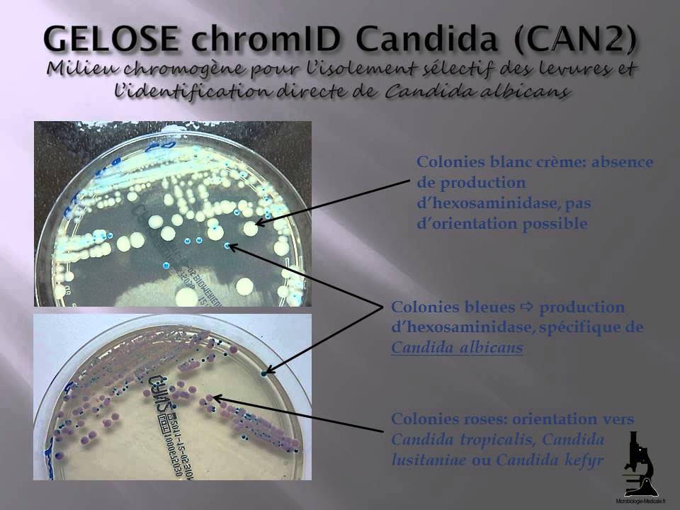 Milieux d'isolement chromogènes - YouTube