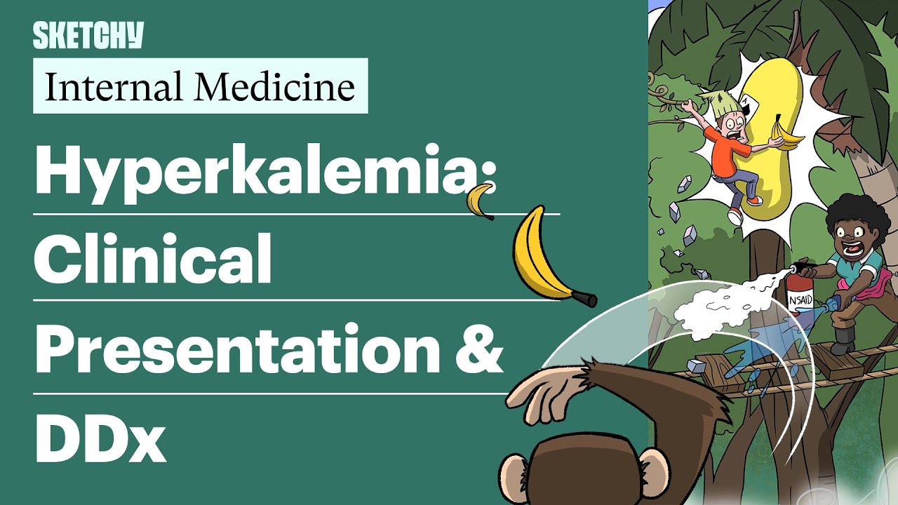 Learn Hyperkalemia: Clinical Presentation & DDx (Internal Medicine ...