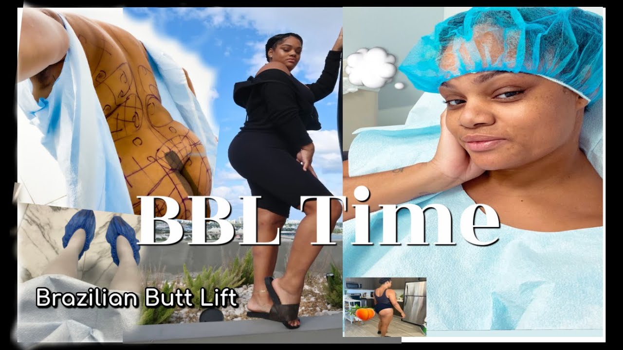 My🍑 BBL SURGERY || EXPERIENCE + NEXT DAY (PIX) - YouTube