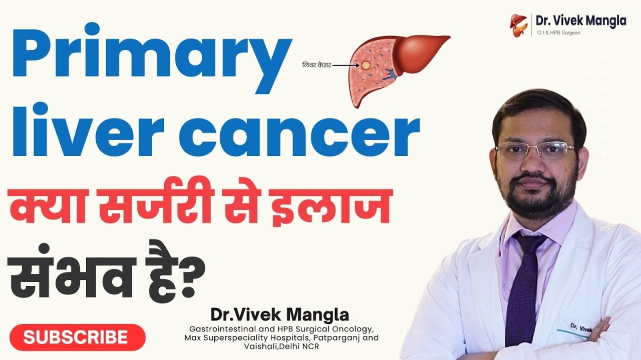 प्राइमरी लिवर कैंसर (HCC) | सर्जरी से सफल इलाज | Dr. Vivek Mangla - YouTube