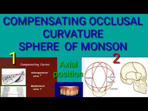 COMPENSATING OCCLUSAL CURVATURE OR SPHERE OF MONSON ( AXIAL POSITION ...