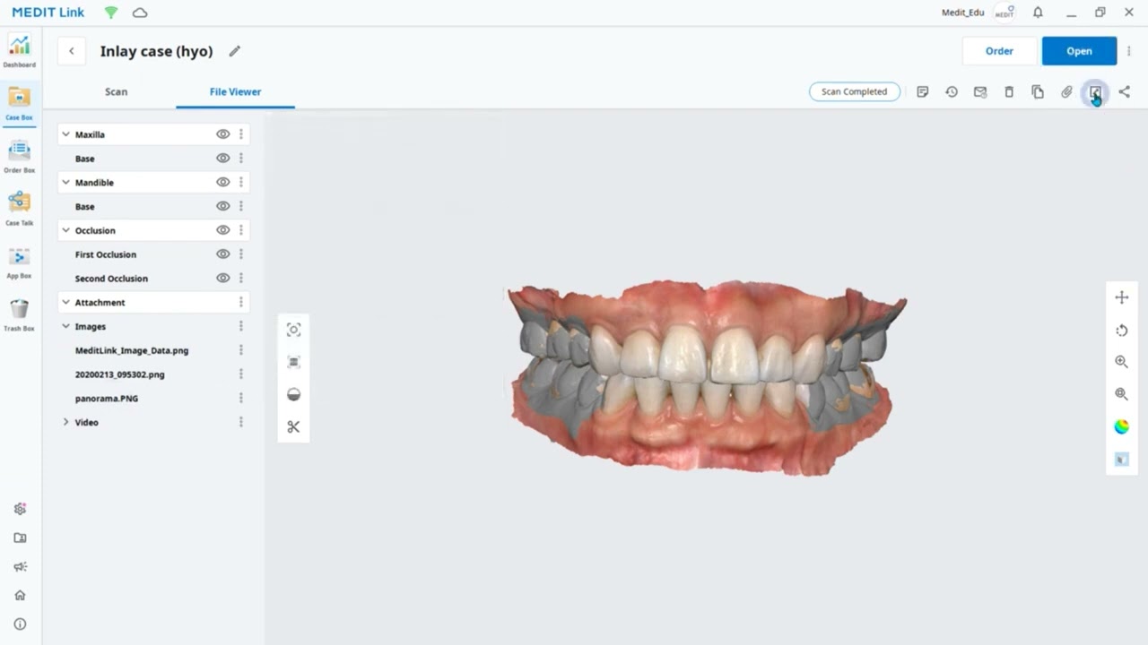 1-2. Medit Link App - Case Box Detail 1 (ENG) - YouTube