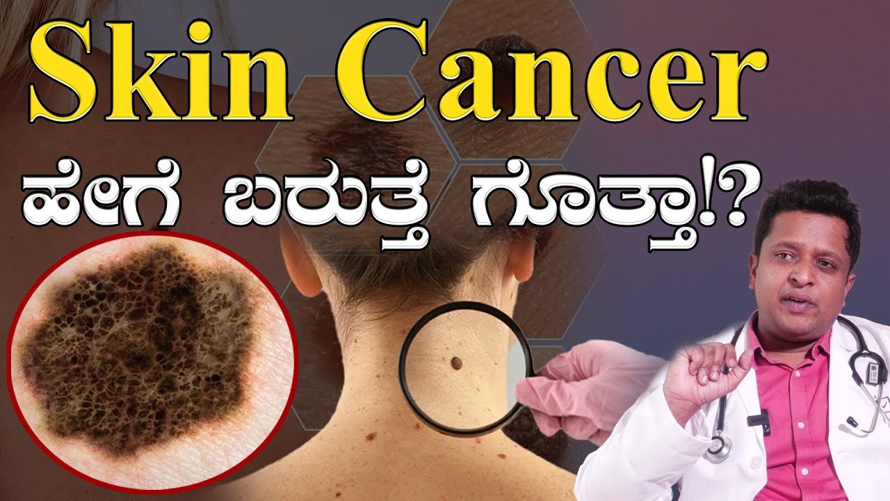 Skin Cancer ಹೇಗೆ ಬರುತ್ತೆ ಗೊತ್ತಾ!? | What is Skin Cancer? | Doctor Tips ...