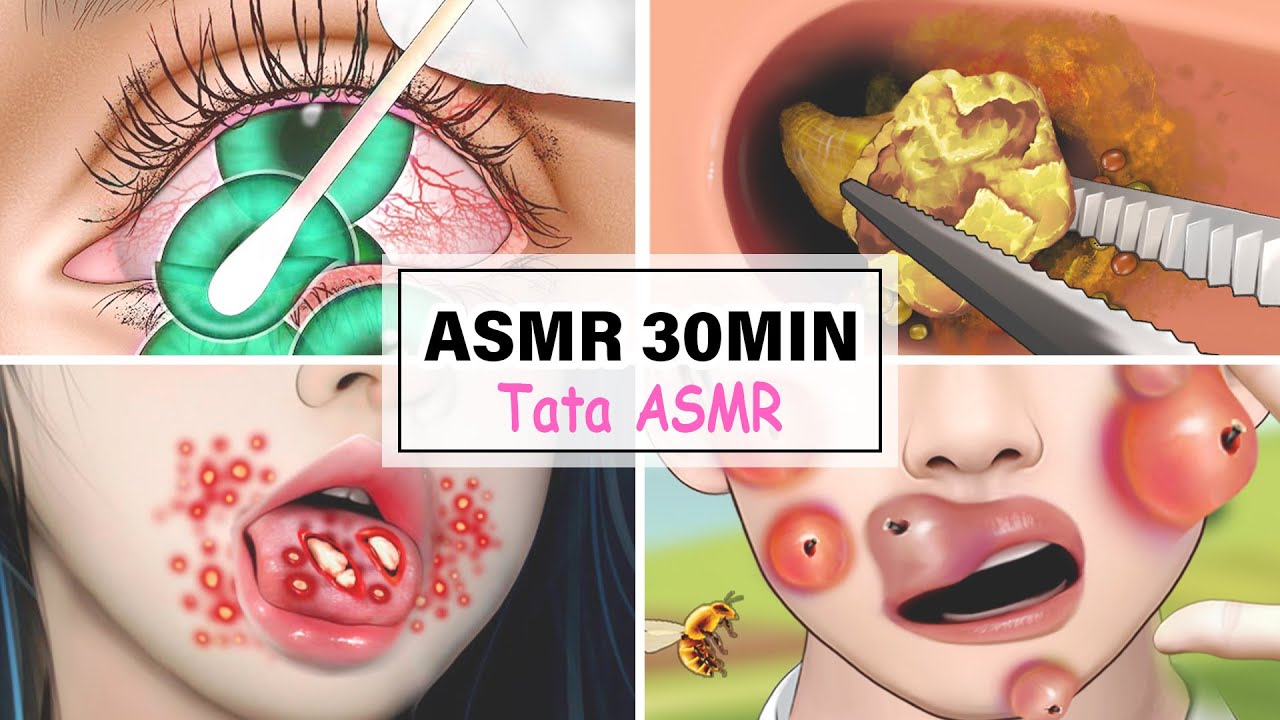ASMR 30 MINUTES SATISFYING COLLECTION: Removing Contact Lenses, Earwax ...