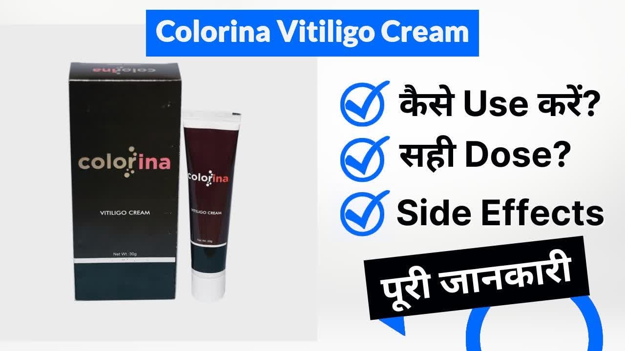Colorina Vitiligo Cream Uses in Hindi | Side Effects | Dose - YouTube