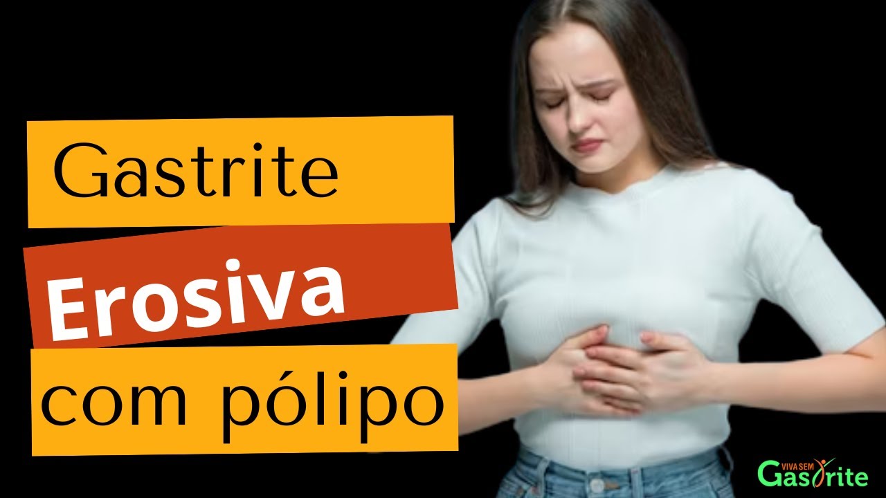 Gastrite Erosiva Plana De Antro - RETOEDU