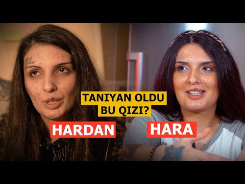 İnsanları mutlu edən qız LALƏ 4 aya belə dəyişdi