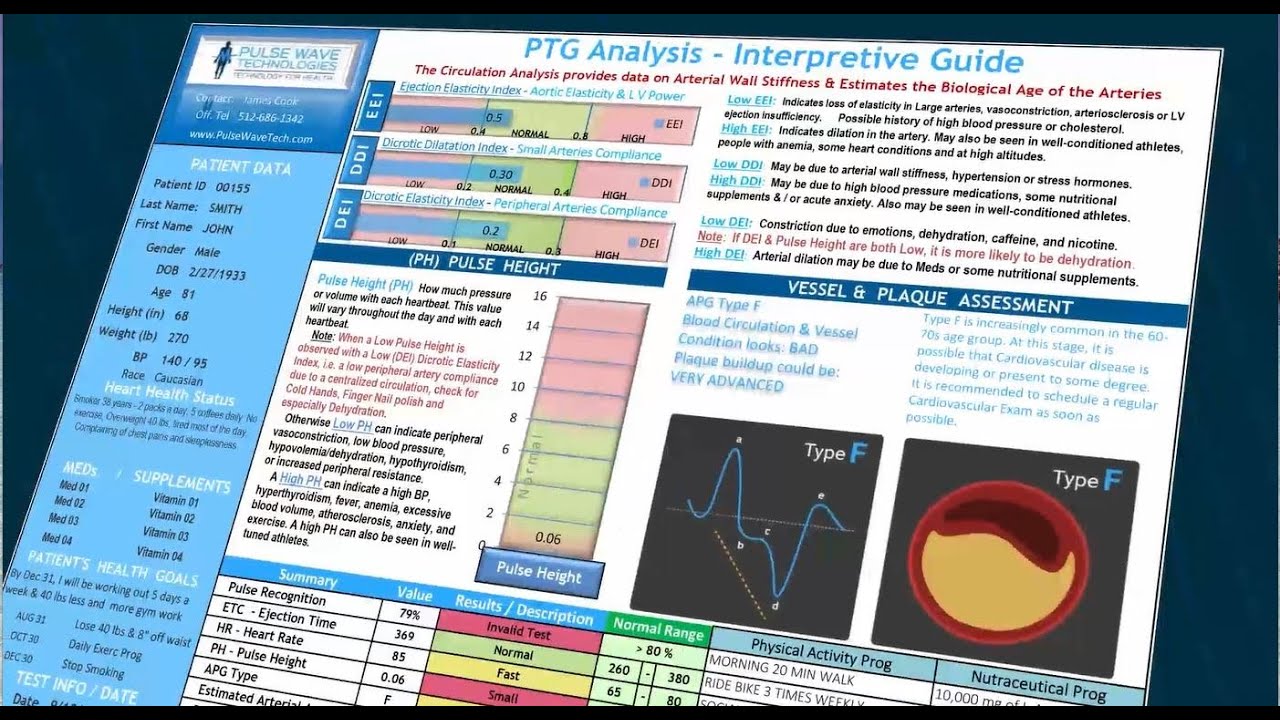 Meridian DPA - 1 Minute PTG using Computer - YouTube