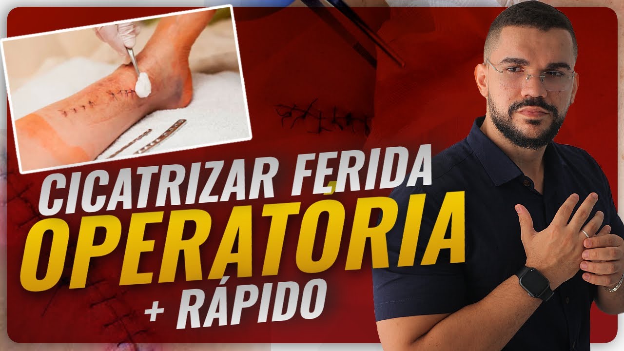 COMO CICATRIZAR UMA FERIDA OPERATÓRIA MAIS RÁPIDO - YouTube
