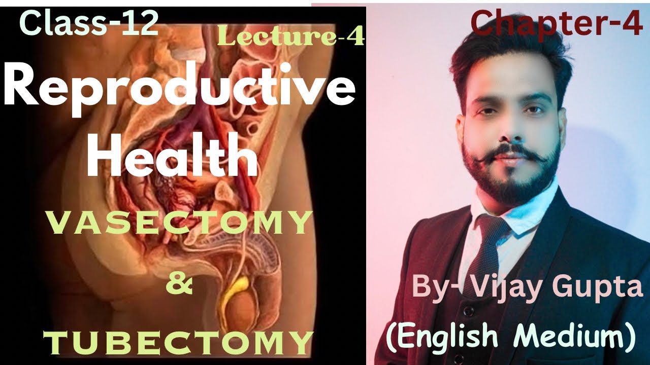 Vasectomy And Tubectomy English Class 12 Chapter 4 Reproductive Health