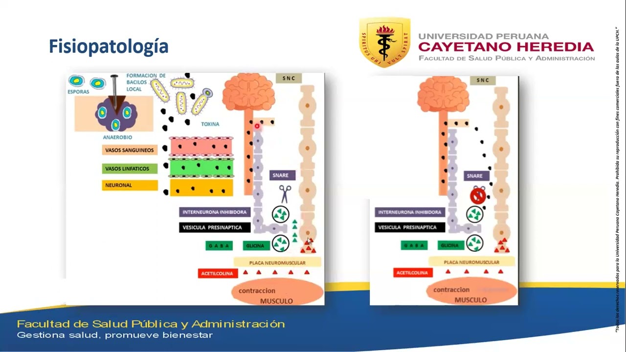 Fisiología y fisiopatología del tetanos - YouTube