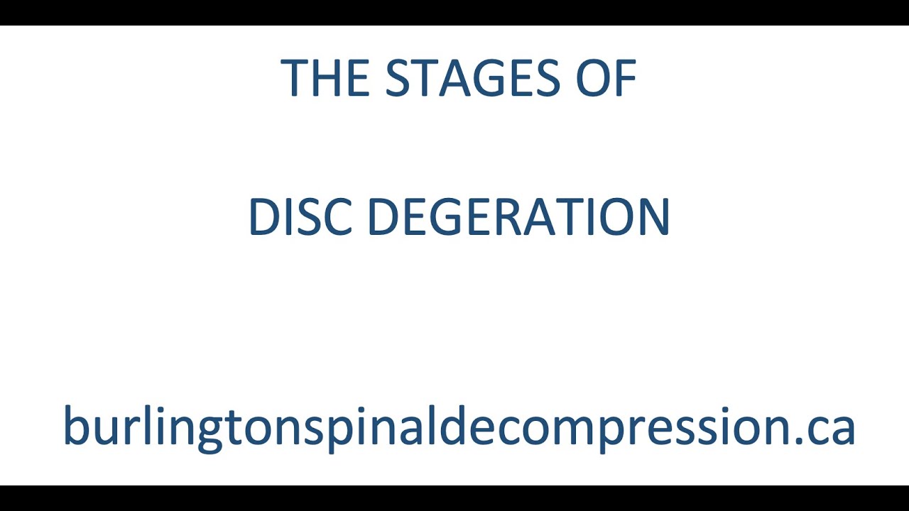 Stages of Disc Degeneration . . . why do discs degenerate? - YouTube