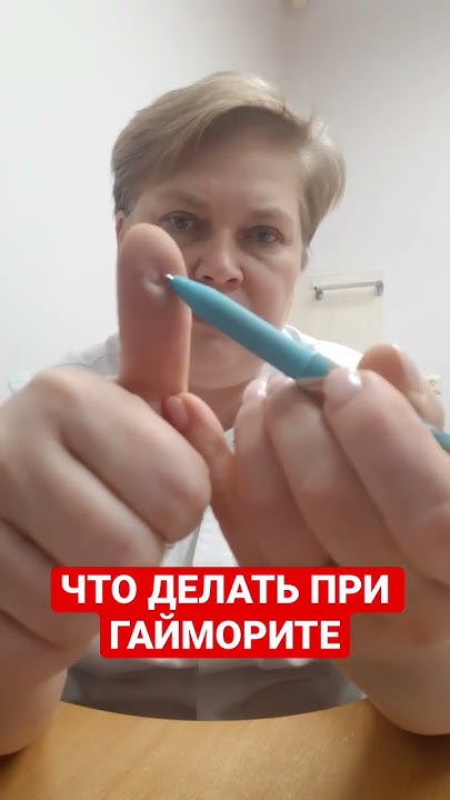 ЧТО ДЕЛАТЬ ПРИ ГАЙМОРИТЕ - YouTube