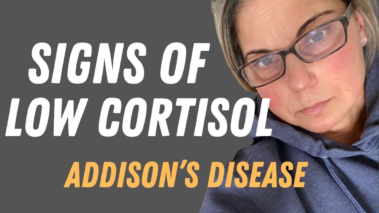 Addison's Disease - Signs of LOW CORTISOL - YouTube