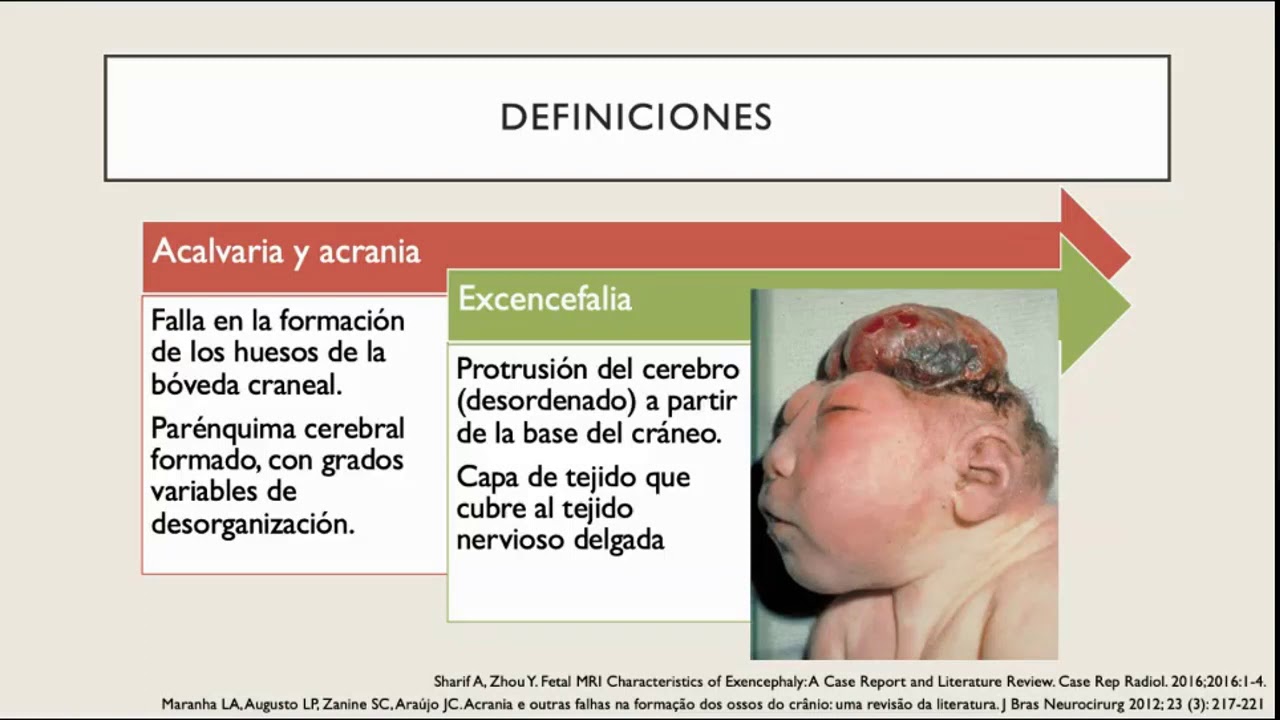 Acranea Acrania - YouTube