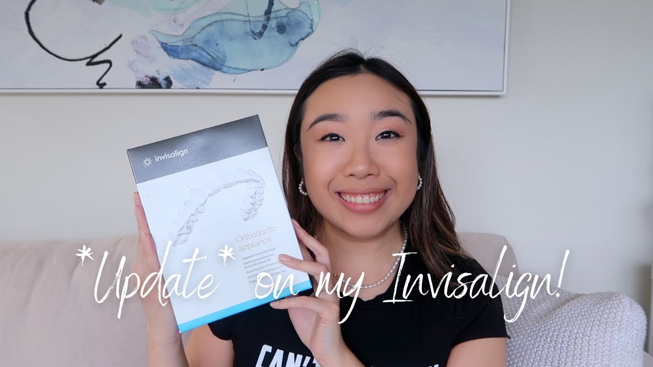 *UPDATE* on my Invisalign Experience | Post treatment, retainers, what I was wrong about - YouTube