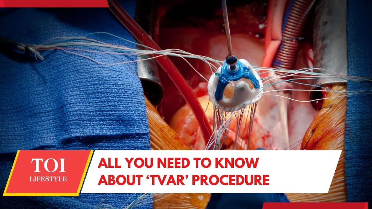 Understanding TAVR: A Breakthrough Treatment for Aortic Stenosis ...