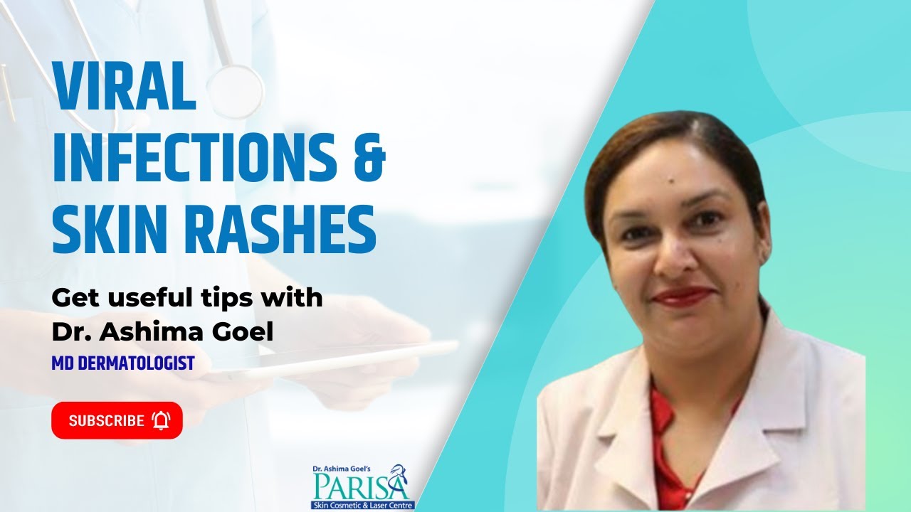 let's talk about Viral Infections and skin rashes| Dr. Ashima Goel ...