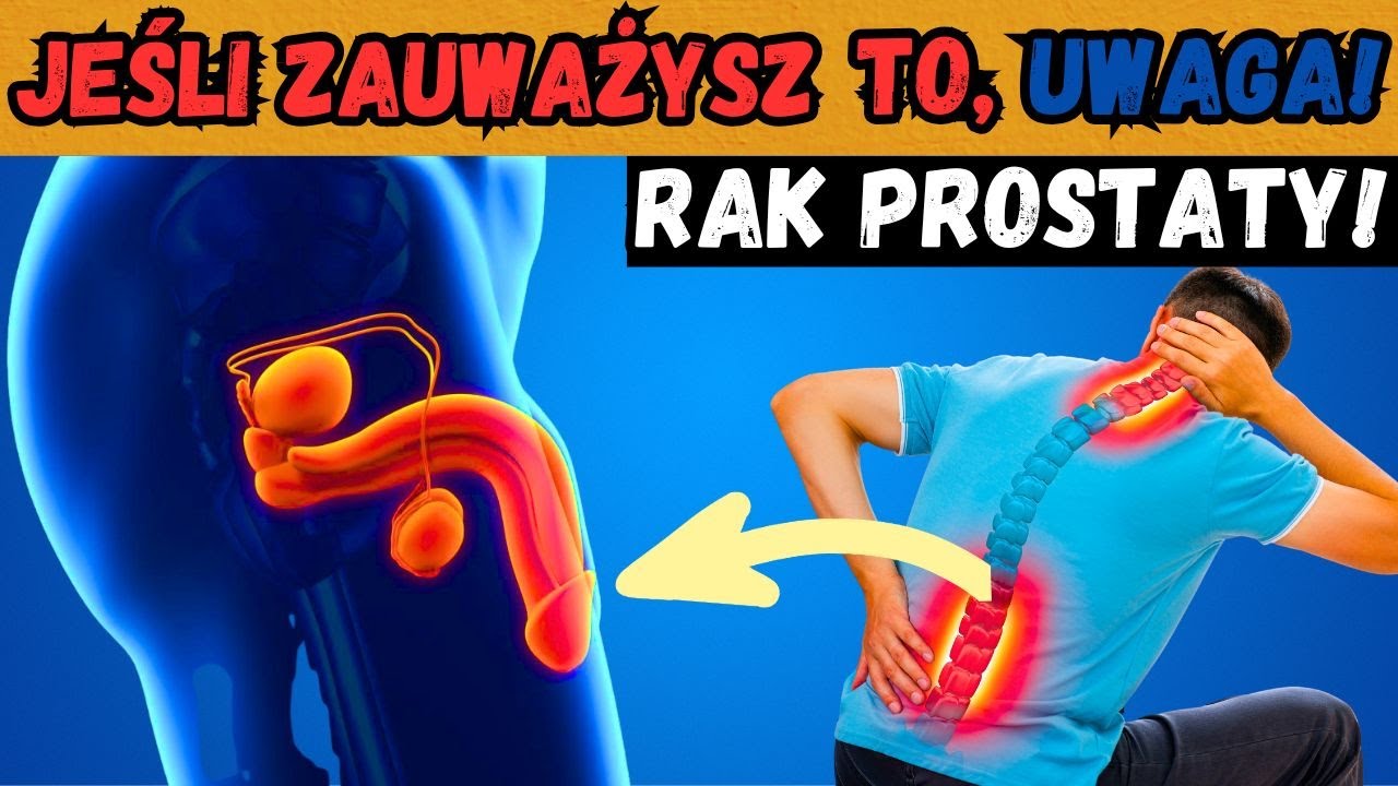 RAK PROSTATY PIERWSZE OBJAWY, KTÓRE MOGĄ URATOWAĆ TWOJE ŻYCIE! - YouTube