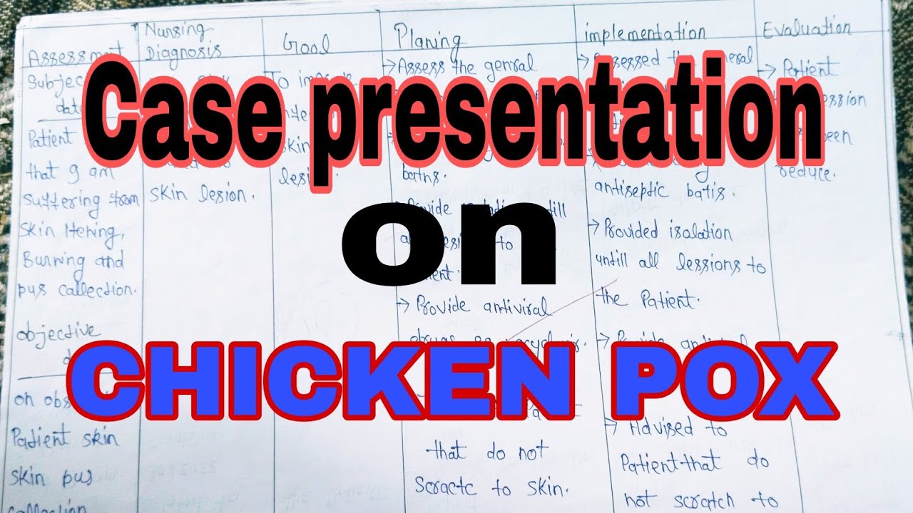 Case Presentation on CHICKEN POX || NCP on Chicken pox ! Care plan on ...