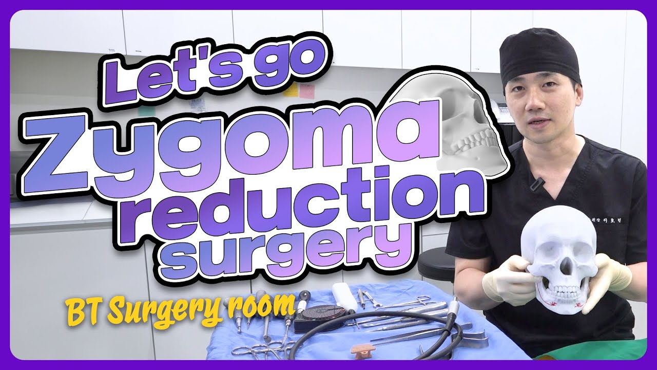 Zygoma Reduction Surgery Korea, Cost and Recovery time - YouTube