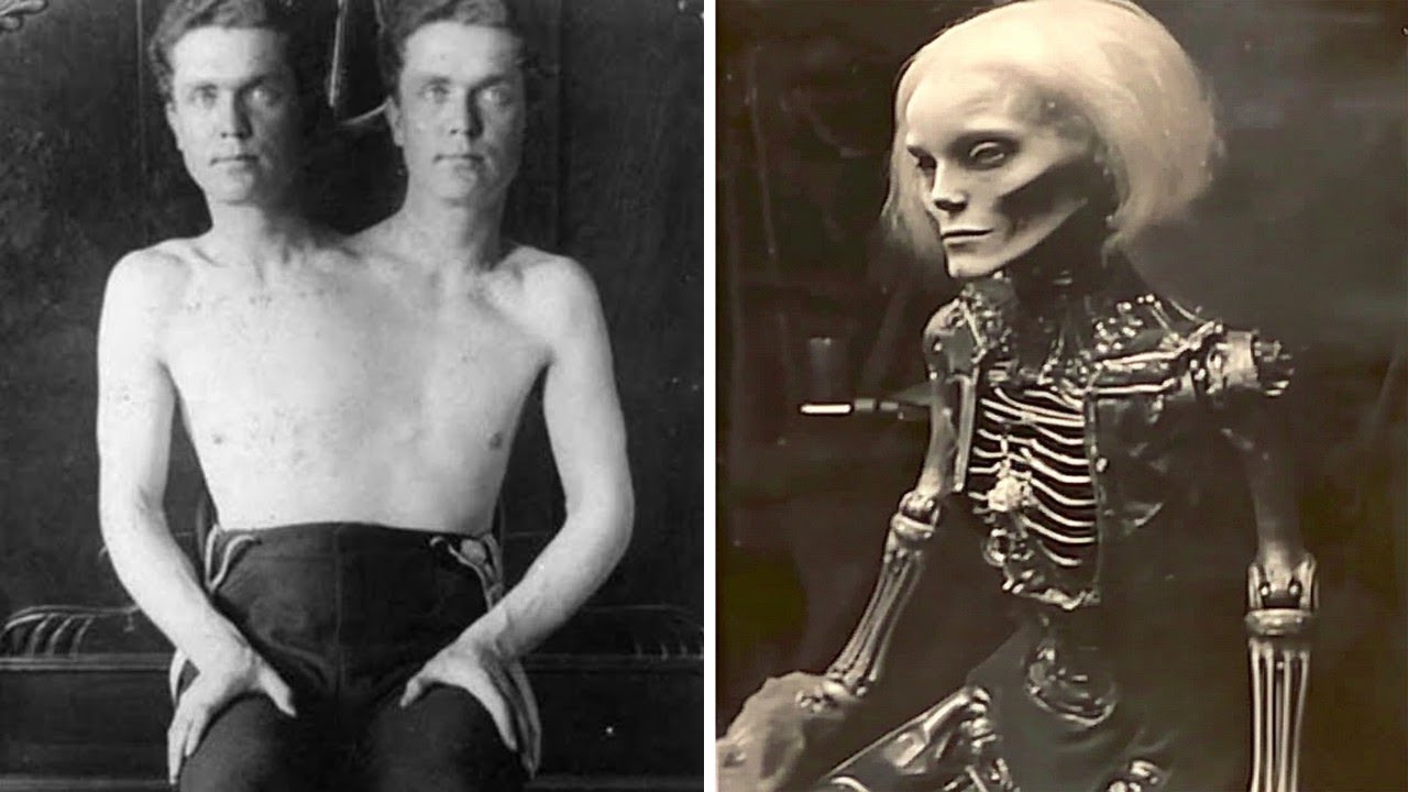 15 Most Weird Circus FREAKS That Actually Existed - YouTube