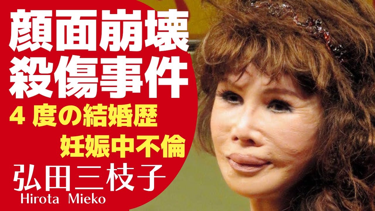弘田三枝子の多重整形で顔面が崩壊している現在に言葉を失った「人形の家」でも有名な歌手の”刺される”ほどの怒りを勝った事件の真相に驚きが隠せない【芸能歌手】 Youtube