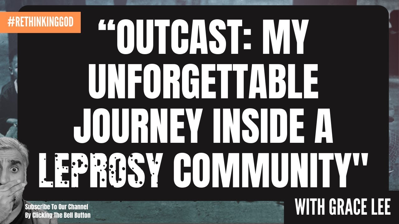 OUTCAST: My unforgettable journey inside a Leper Colony. WOW! - YouTube