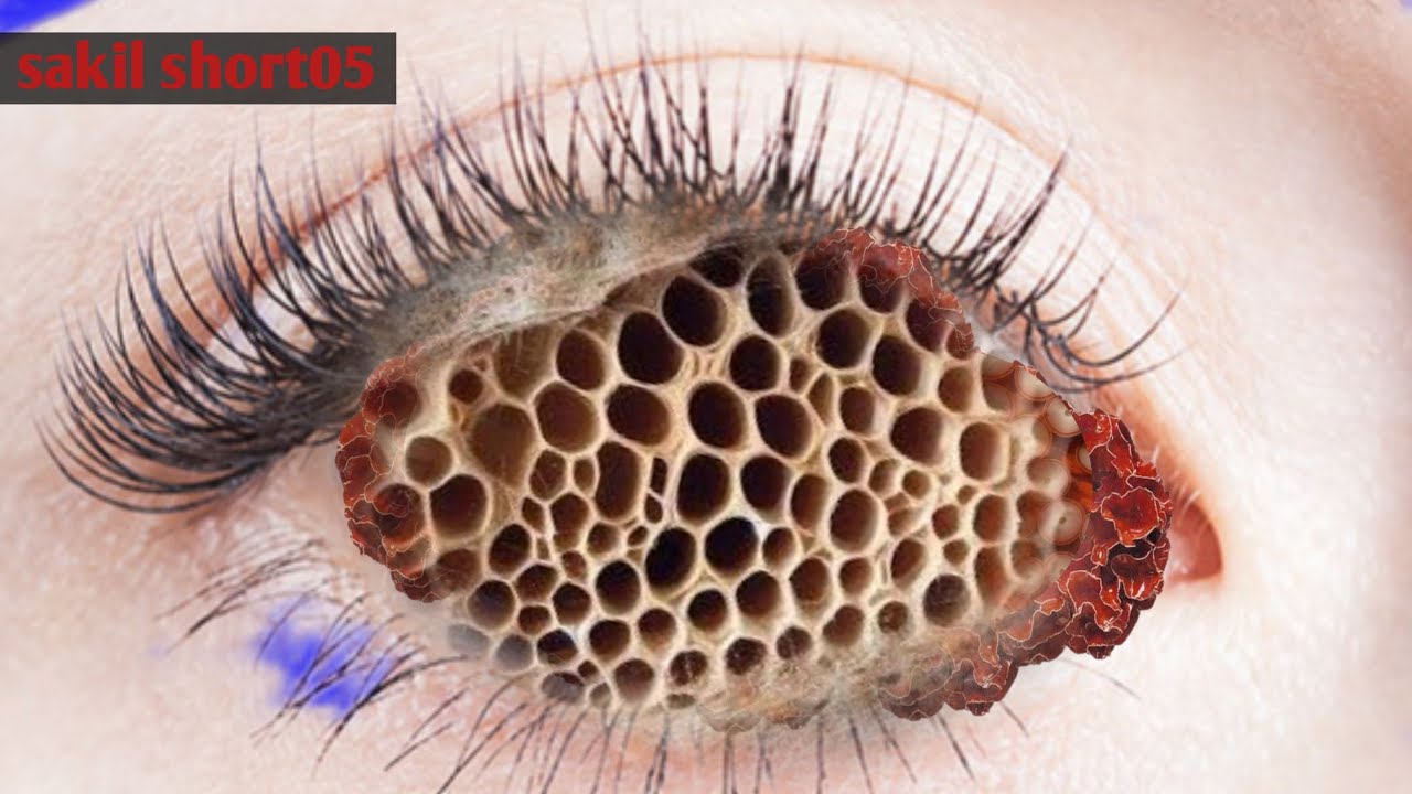 What happened 😭 eye infected cutting removal maggot 2d surgery | # ...