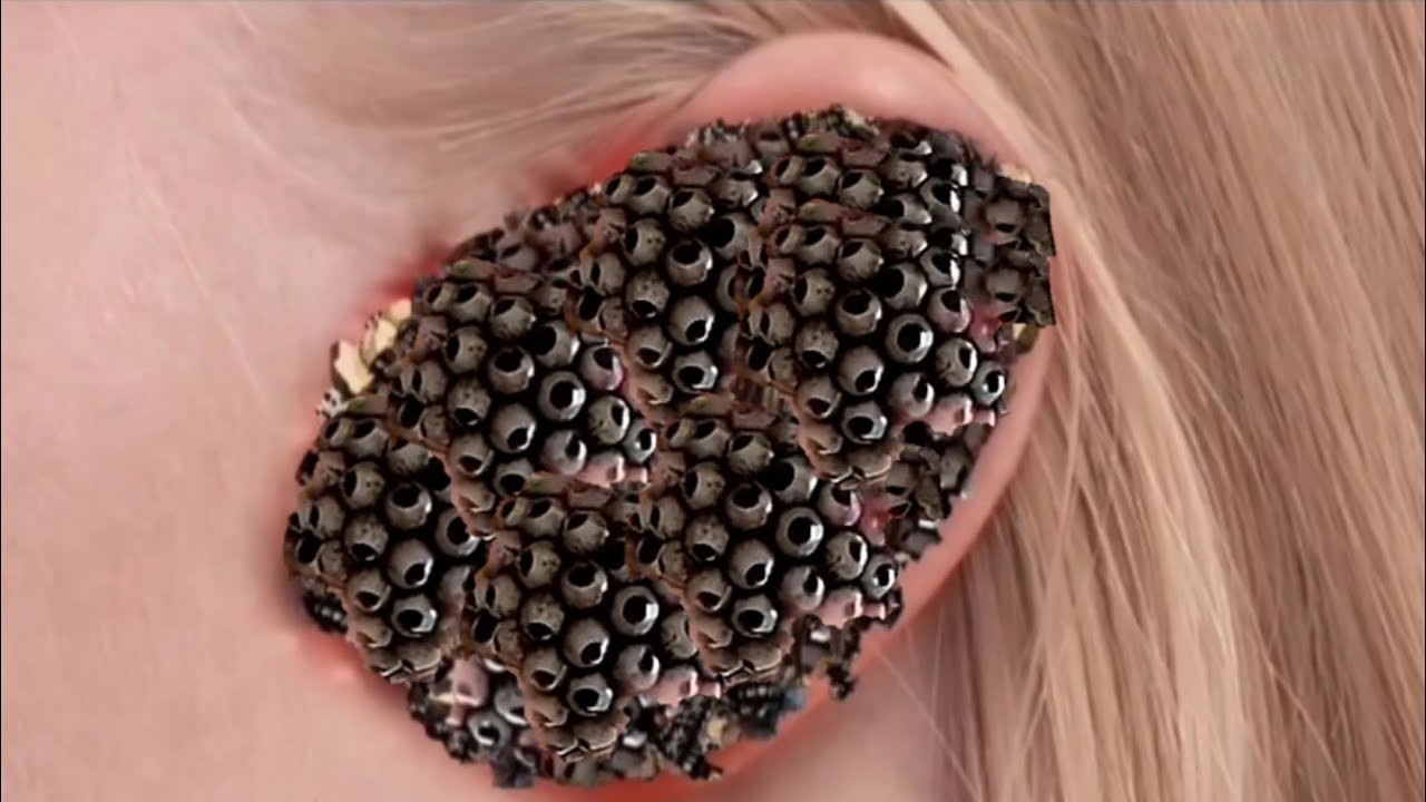 ASMR Animation Treatment 🚑 Infected Ears,, Treatment Ear Collection 🚑 ...