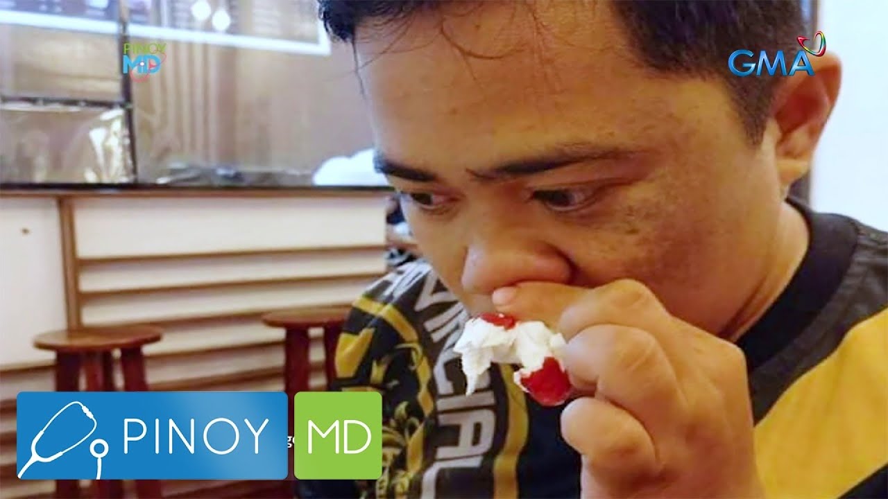Lalaki, tatlong beses kada araw daw kung mag-nosebleed? | Pinoy MD ...