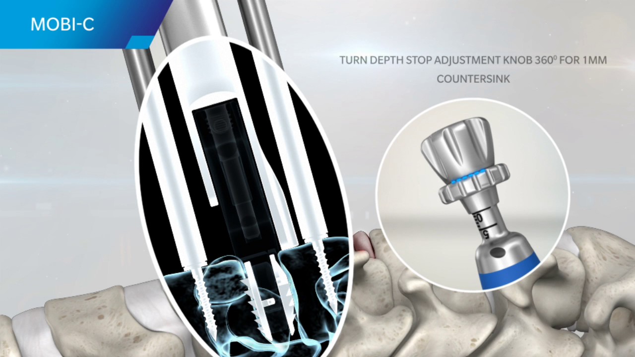 Mobi C Ease of Insertion - YouTube