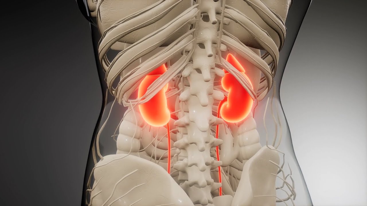 ¿Qué es un cólico nefrítico? #mundotv - YouTube