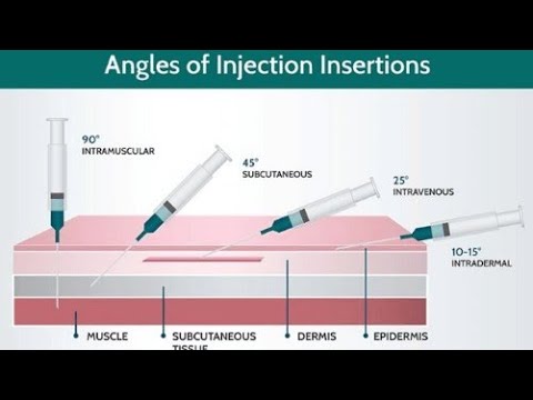 Types of injection. - YouTube