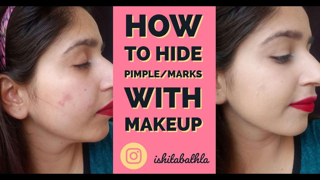 How To Hide Pimple Marks With Makeup In Hindi Hide Hyper Pigmentation how-to-hide-pimple-marks-with-makeup-in-hindi-hide-hyper-pigmentation