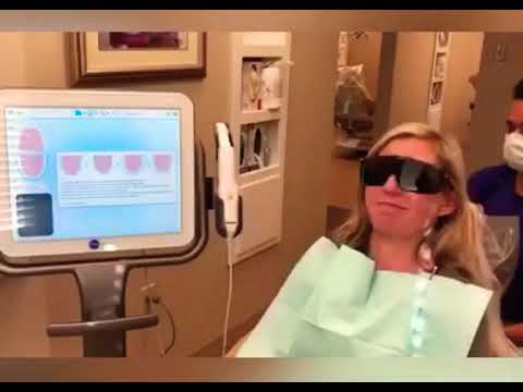 Invisalign scan using the Itero Element - YouTube