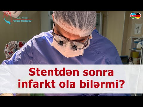 Stentdən sonra infarkt ola bilərmi? Urek cerrahi cavab verir (İcbari tibbi sığorta keçərlidir)