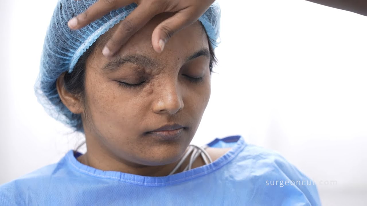 Neurofibroma Tumor Removal Surgery - Before & After - YouTube