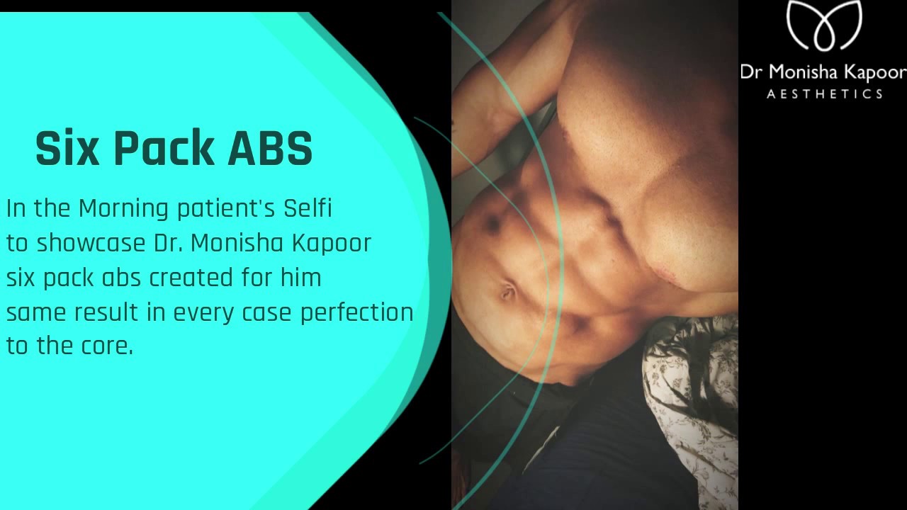 six pack abs surgery in Delhi | 4D high definition surgery - YouTube