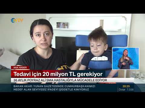 36 aylık  Poyraz Ali bebek SMA hastalığı ile mücadele ediyor...