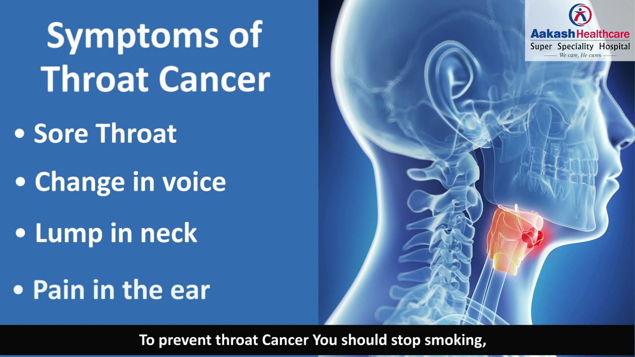 Throat Cancer Causes Symptoms Prevention And Treatment Dr Arun