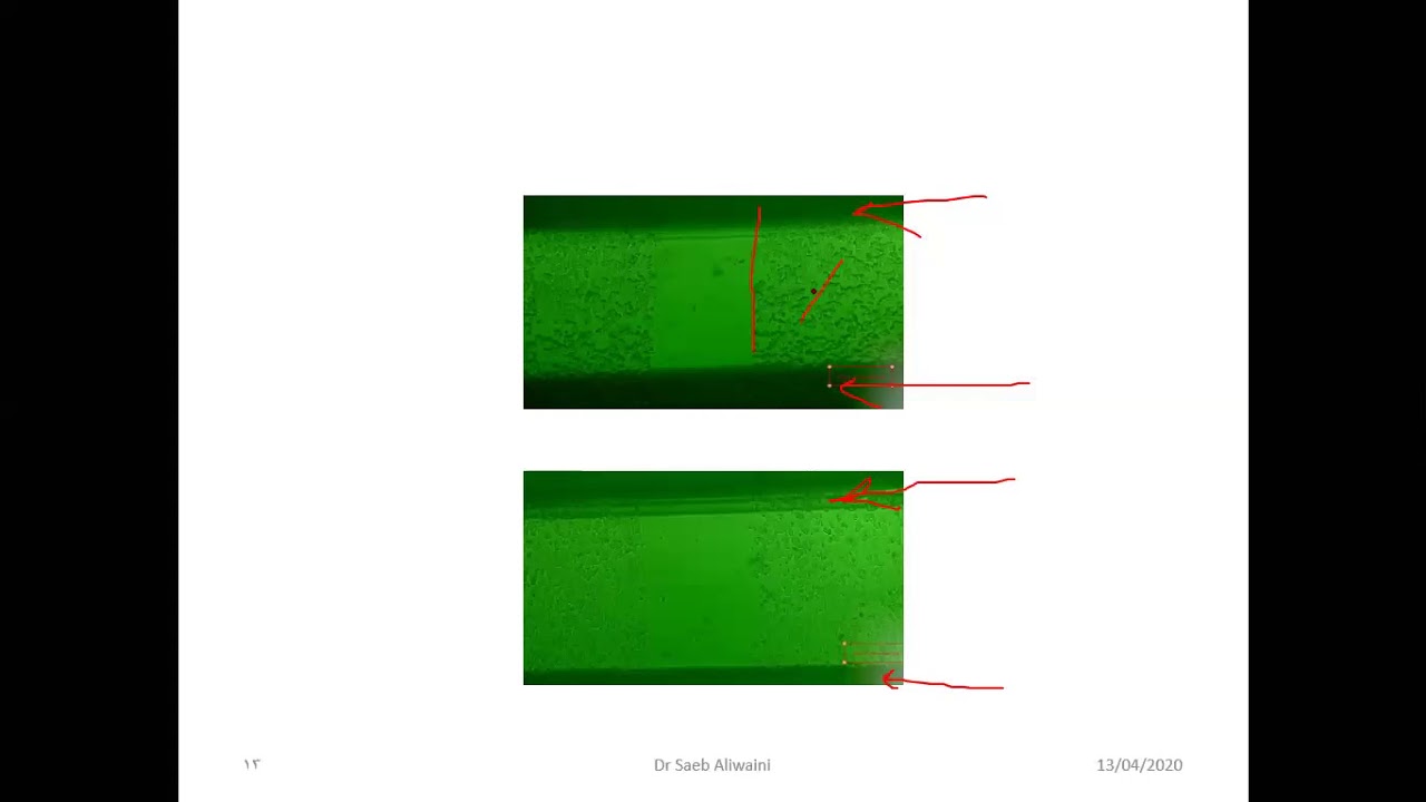 Scratch assay - YouTube