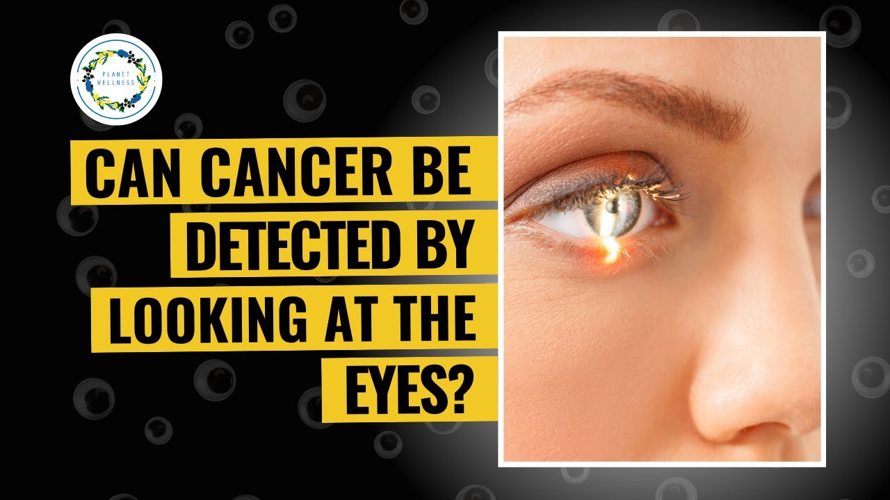 Can Cancer Be Detected By Looking At The Eyes YouTube can-cancer-be-detected-by-looking-at-the-eyes-youtube