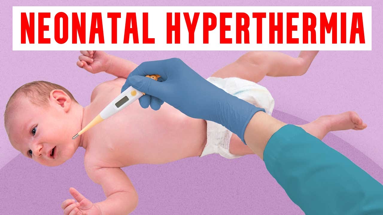 NEONATAL HYPERTHERMIA - YouTube