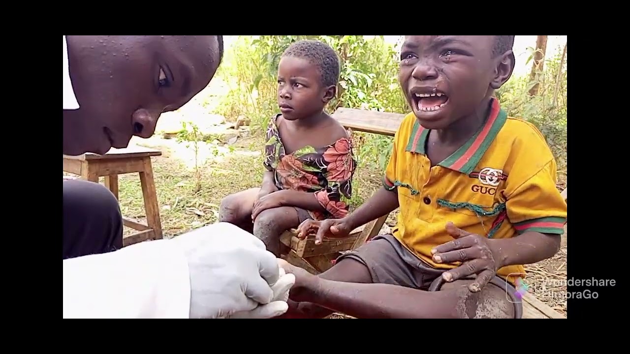 Tough Jiggers Attack. OMG!!!! - YouTube