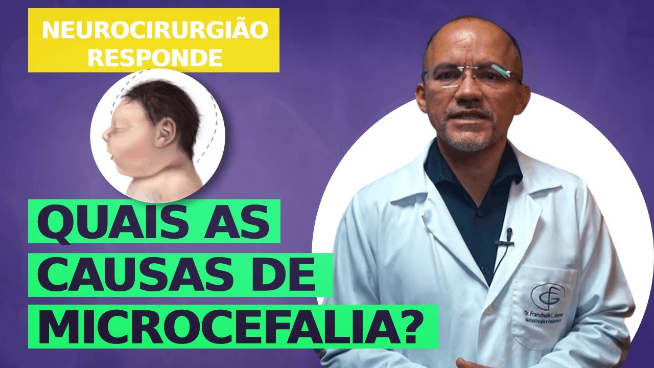 Principais Causas de Microcefalia. Neurocirurgião Responde! - YouTube