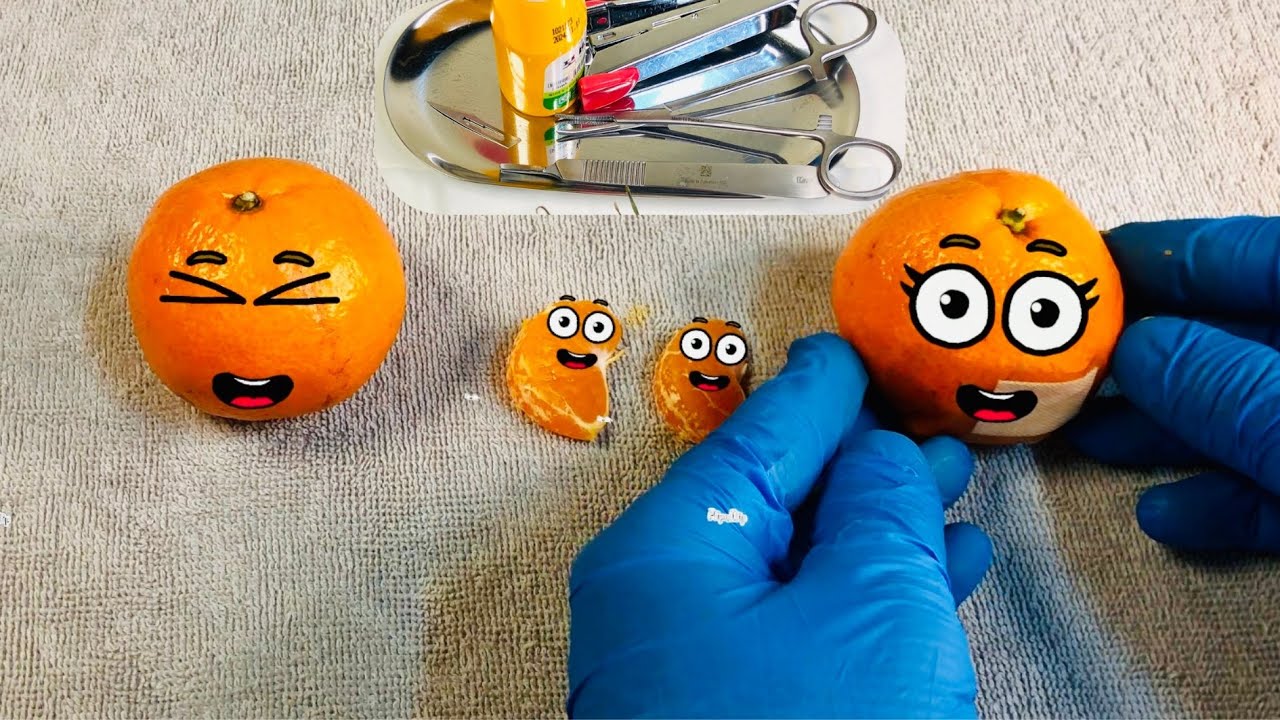 @ABMfamily7#doodle orange surgery #orange - YouTube