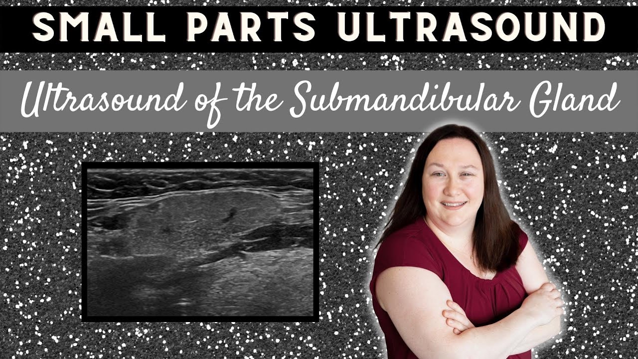 Submandibular Gland Ultrasound Anatomy