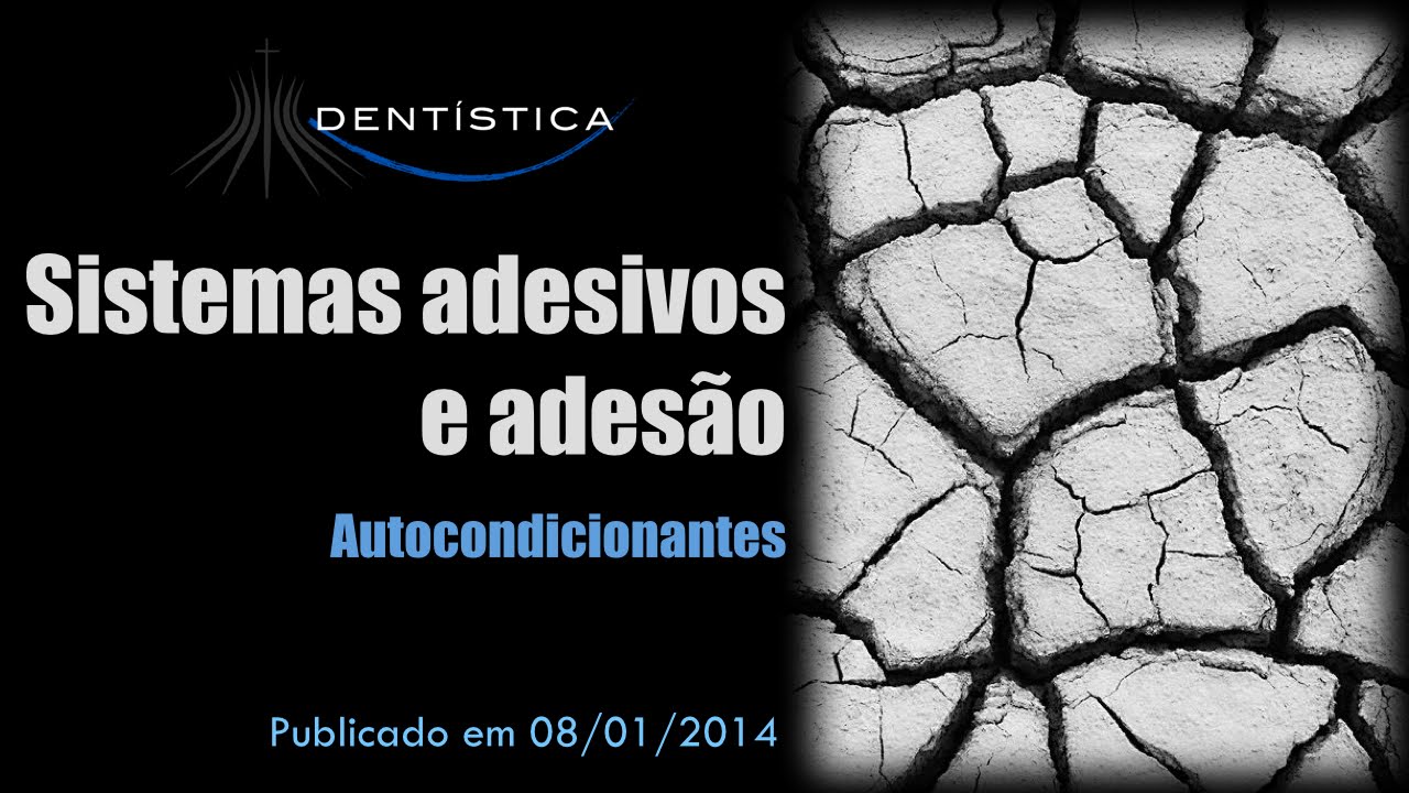 Sistemas Adesivos e Adesão - Autocondicionantes - YouTube